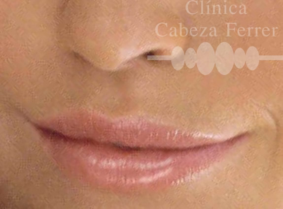 Clínica Cabeza Ferrer